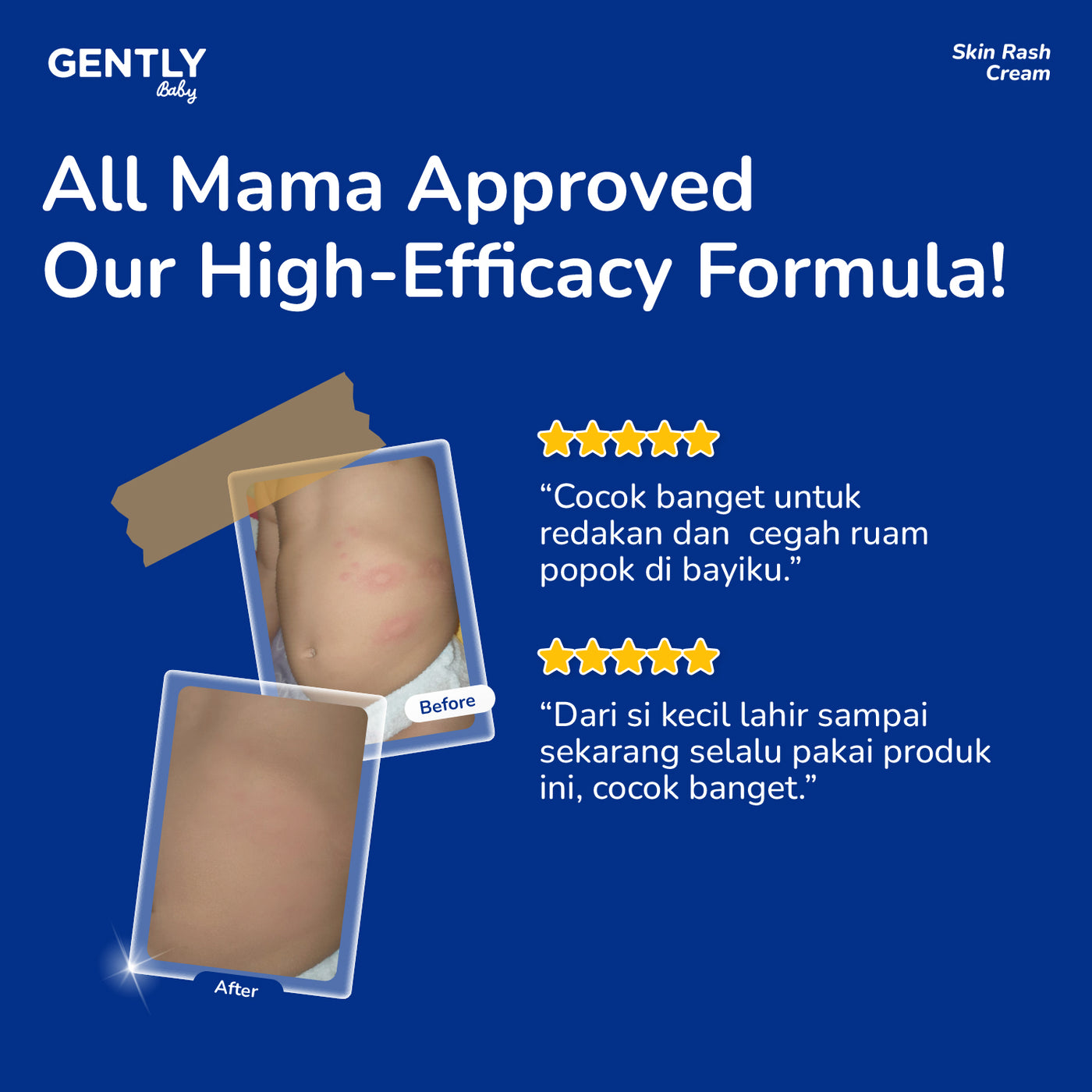 GENTLY Baby Rash Cream 20gr